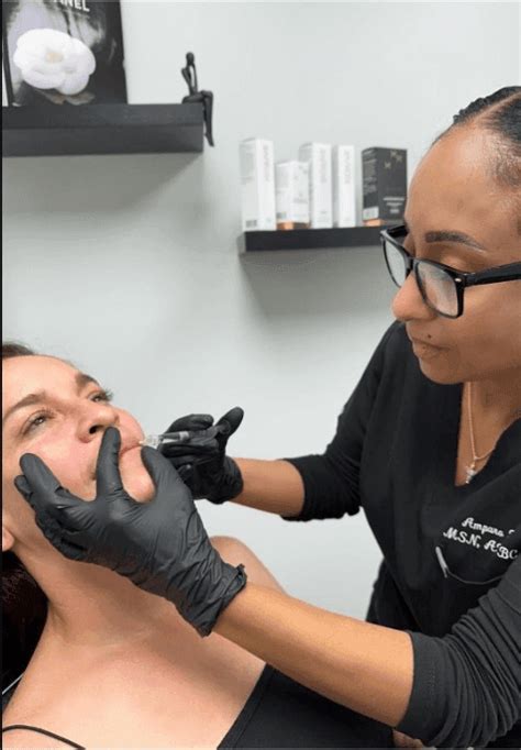 Lip Flip Results Day By Day What To Expect From Your Treatment