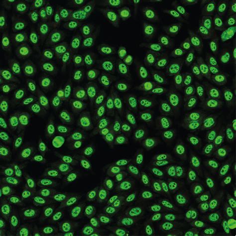 Indirect Immunofluorescence Assays Ifa Sebia En Nl