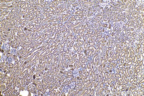 Ihceasy Bax Ready To Use Ihc Kit Khc0768 Proteintech 武汉三鹰生物技术有限公司