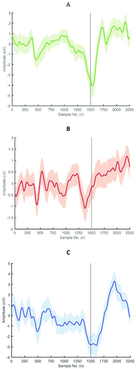 movement related cortical potential mrcp averages with 95 confidence