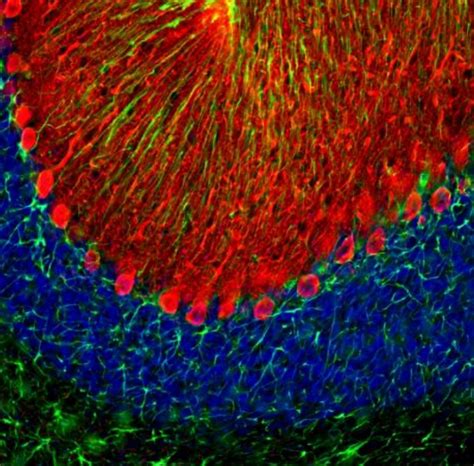 Anti Gfap Antibody Astrocyte Marker Ab254082 Abcam