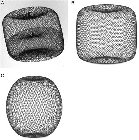 Endovascular Treatment Of Intracranial Aneurysms With The Woven Endobridge Device Mid Term And