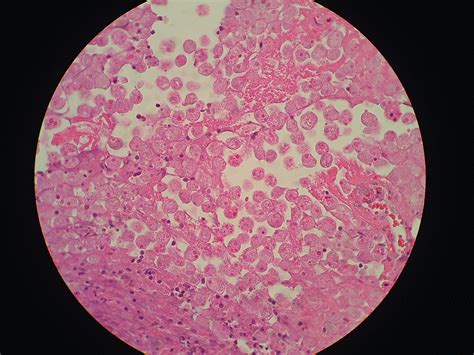 Parasites Gallery