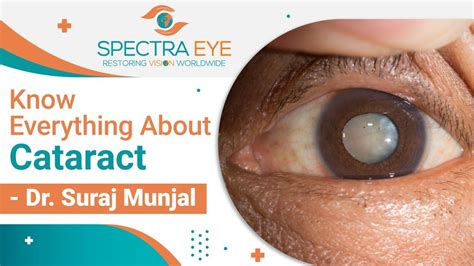 Know Everything About Cataract By Dr Suraj Munjal Spectra Eye