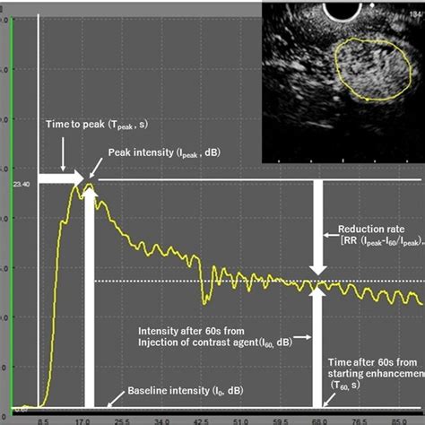 Quantitative Assessment With Time Intensity Curve Tic Analysis Of Download Scientific Diagram