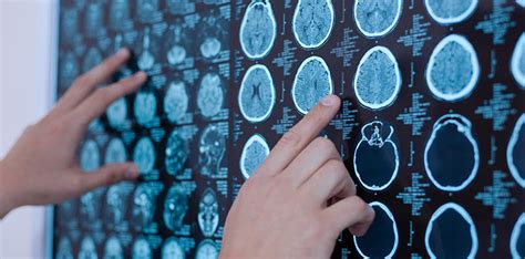 Sarcoma Symptoms 7 Symptoms Of Sarcoma To Be Aware Of