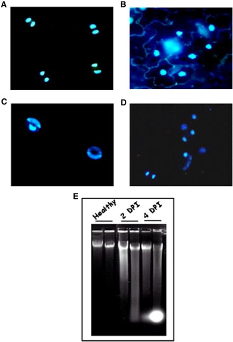 Necrosis In Alternaria Infected Areas On B Juncea Leaves Dapi Stained