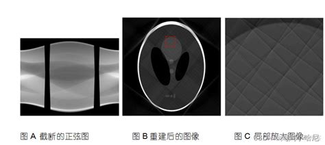 医学图像伪影的消除 python 医学影像伪影 mob6454cc61df1e的技术博客 51cto博客