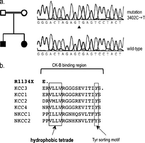Identification Of A Novel Hmsnacc Truncating Mutation A Mutated