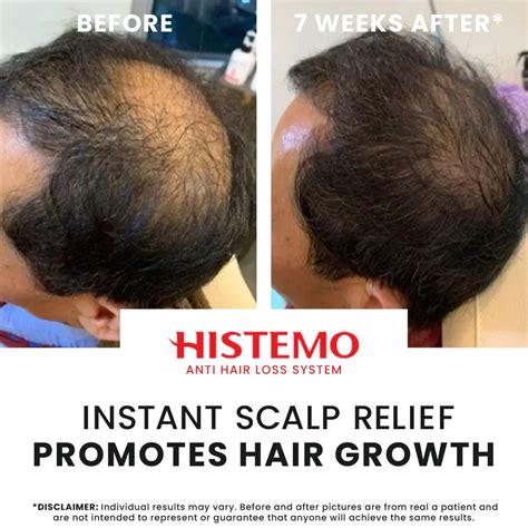 Home Care Histemo Middle East