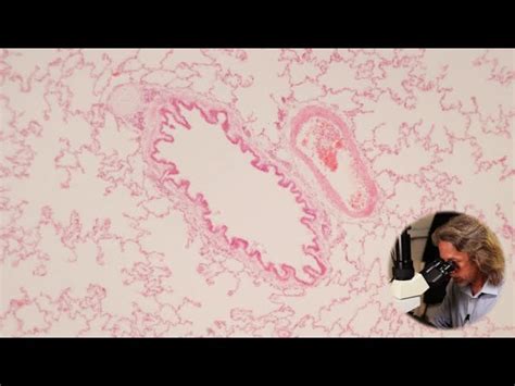 Free Video Histology Of The Airway And Lungs A Visual Exploration