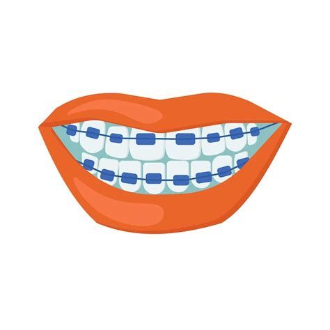 Premium Vector Dental Braces Orthodontic Instrument For Teeth