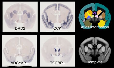 Gene Expression Connectivity Mapping Brainminds