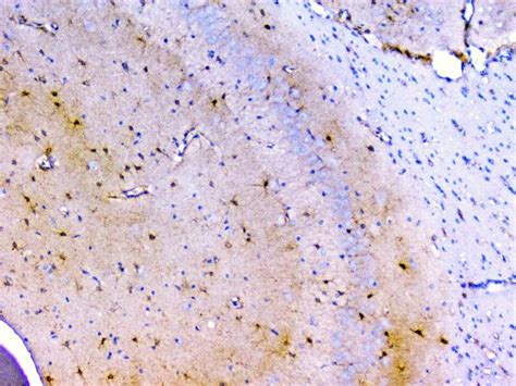 Peroxiredoxin PRDX Antibody