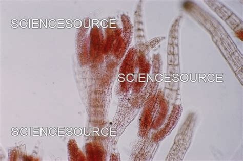 Polysiphonia Under Microscope