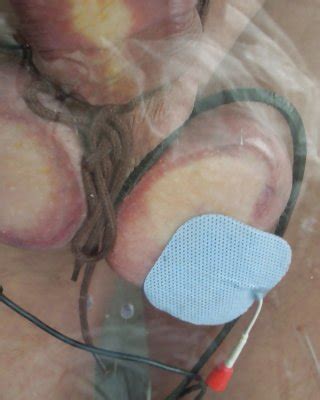 Extreme Electric Cock Ball Squash Porn Pictures XXX Photos Sex Images 1831803 PICTOA