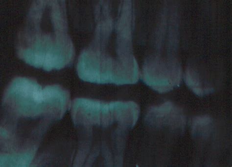 Exposure And Technique Errors Ch 20 Flashcards Quizlet