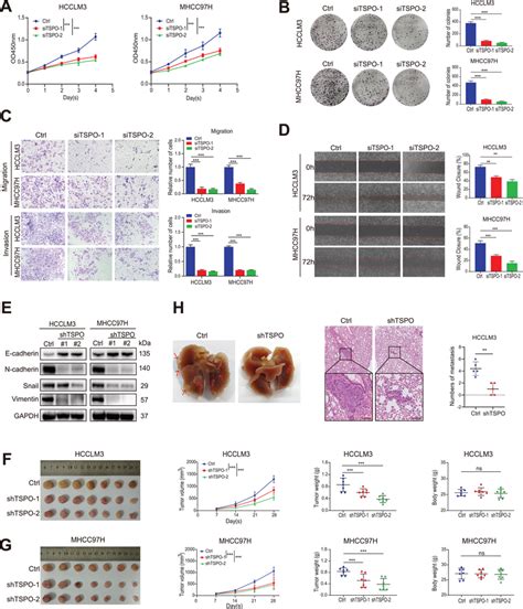 Knockdown Of Tspo Inhibits Hcc Cell Proliferation Invasion And