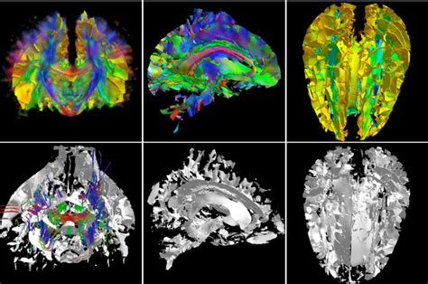 Ridge And Valley Surfaces Of Fa In A Dt Mri Dataset Of A Human Brain Download Scientific