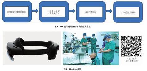 混合现实技术在神经外科应用的研究进展 医学界 助力医生临床决策和职业成长