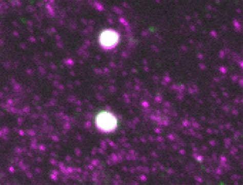 How To Remove Noisy Signal Image Analysis Image Sc Forum