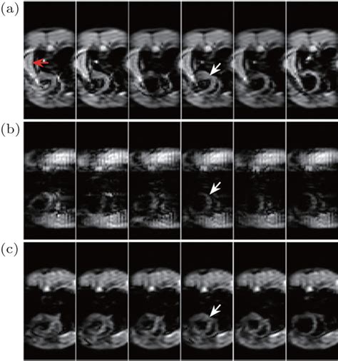 Flexible Reduced Field Of View Magnetic Resonance Imaging Based On Single Shot Spatiotemporally