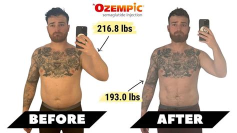 Ozempic Before And After I Lost More Than Just Weight My Shocking 74