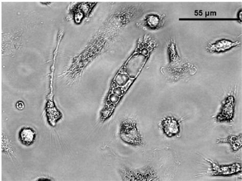 Apoptotic Cells After Differentiation In Serum Cultures The Apoptosis