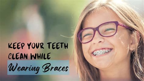 How To Keep Your Teeth Clean While Wearing Braces