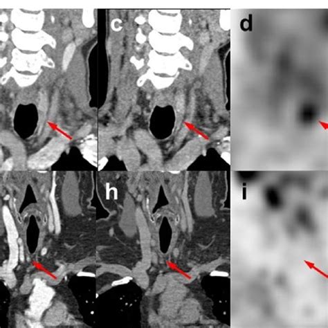 Multiphase Spectct Coronal Views For 2 Patients Upper And Lower Rows