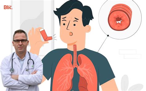 Astma Shkaktarët Simptomat Dhe Trajtimi I Sëmundjes Gazetablic