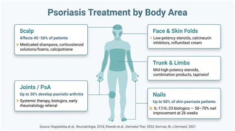 Psoriasis Treatment Evidence Based Options For Every Severity Harlanmd