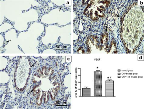 Photomicrographs Of Vegf Immunohistochemical Staining Of Rat Lung Download Scientific Diagram