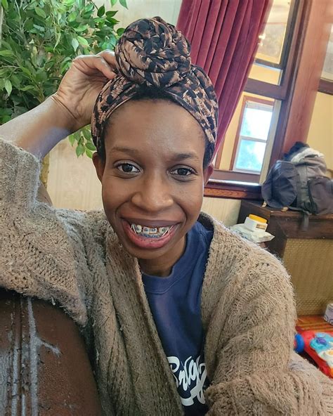 Braceface At 34 Rbraces