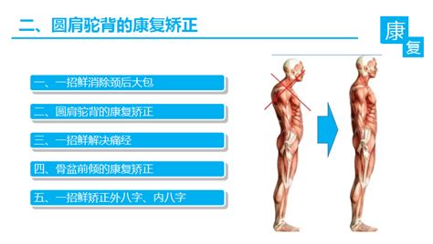 圆肩驼背矫正的视频教程 知乎