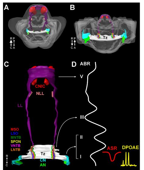 Figure 1 From Central Auditory And Vestibular Dysfunction Are Key