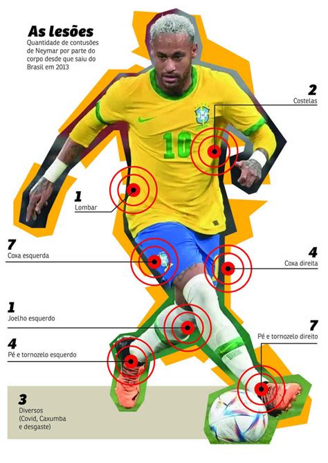 Corpo Marcado Pela Dor As 29 Lesões De Neymar Desde O Adeus Ao Brasil