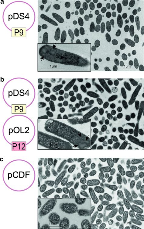Thin Sections Of E Coli Cells Expressing P9 And P12 E Coli Bl21de3