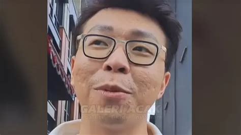 Penjelasan Richard Lee Soal Wajahnya Yang Tampak Bopeng Saat Tersorot