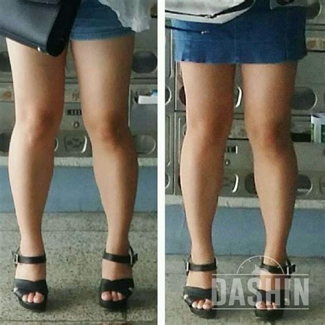 비포and애프터 미세한 눈바디 체크☆ 데헷 다이어트신