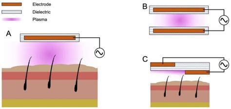Our Review Article On Cold Atmospheric Plasma Medicine Applications Challenges And