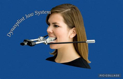Adam Bordick Bsn Rn On Linkedin The Jaw Dynasplint® System Aids In Restoring Physical Function