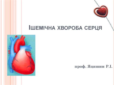 Ішемічна хвороба серця презентация онлайн