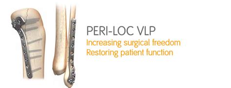 Variable Angle Locked Plating System At Best Price In Mumbai