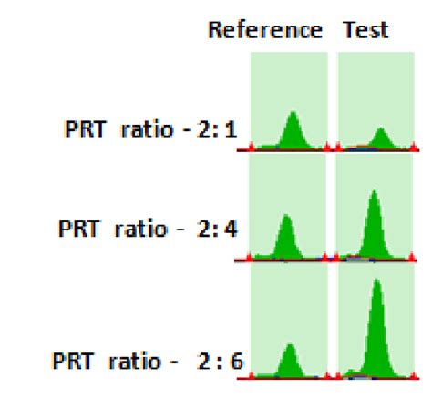 An Example Of A Genemapper® Electropherogram Showing The Test Locus And