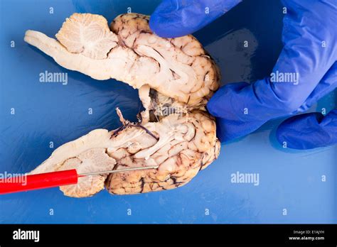 Brain Stem Cross Section