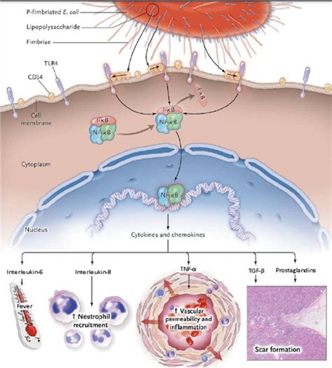 Pathophysiology Pyelonephritis