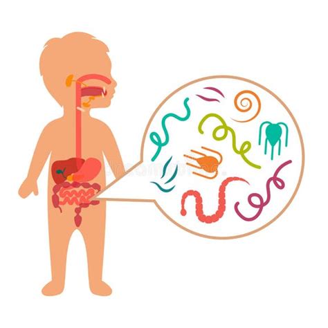 Ilustrarea Vectorială A Unei Boli A Paraziților Intestinali Ai Unui