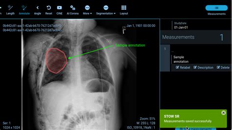 How To Save Measurements And Annotations For A Dicom Hosted In Orthanc