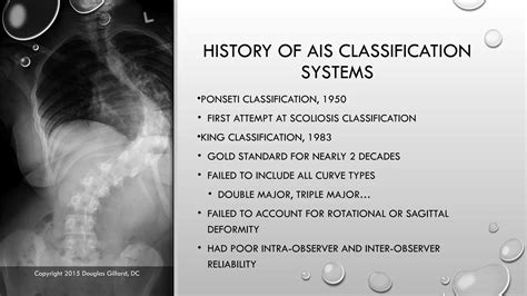 Lenke Classification For Adolescent Idiopathic Scoliosis Ais Ppt